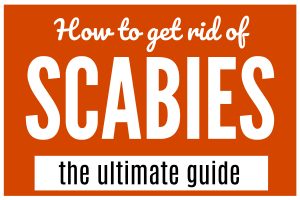 How To Get Rid Of Scabies: The Ultimate Guide That WORKS | Scabies home ...